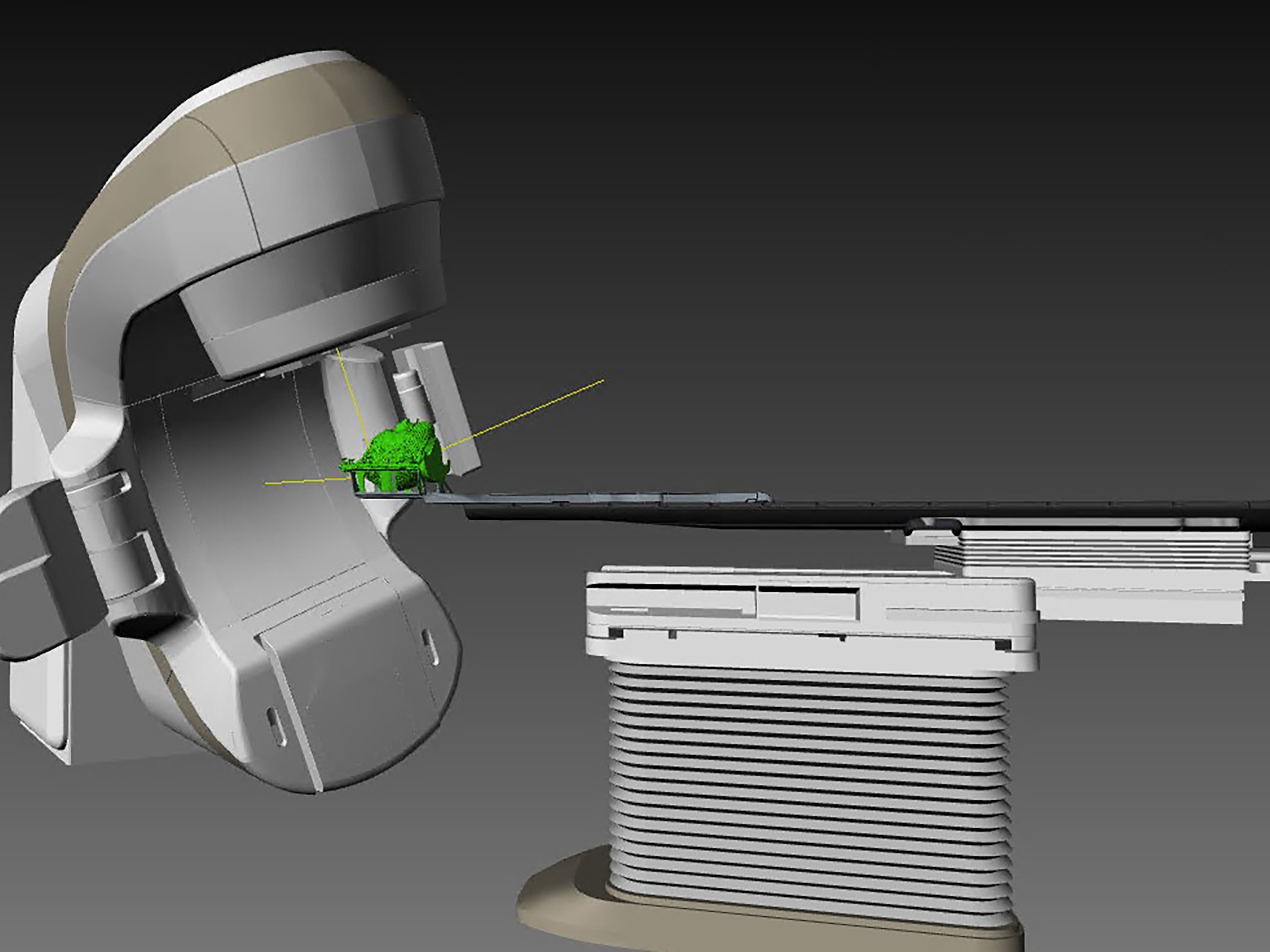 Radiothérapie stéréotaxique cérébrale avec le système HyperArc - Centre ...