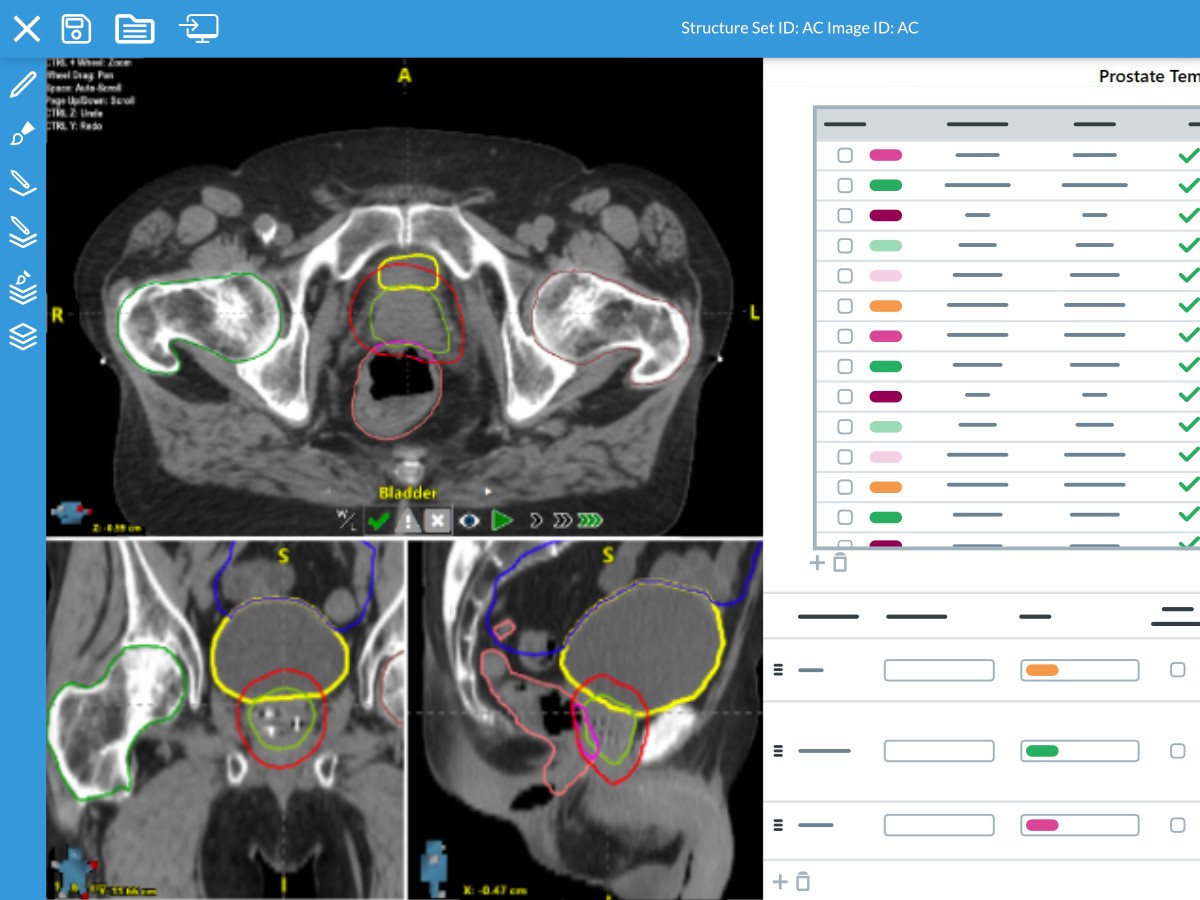 Logiciel de délinéation automatique - Centre de la Baie